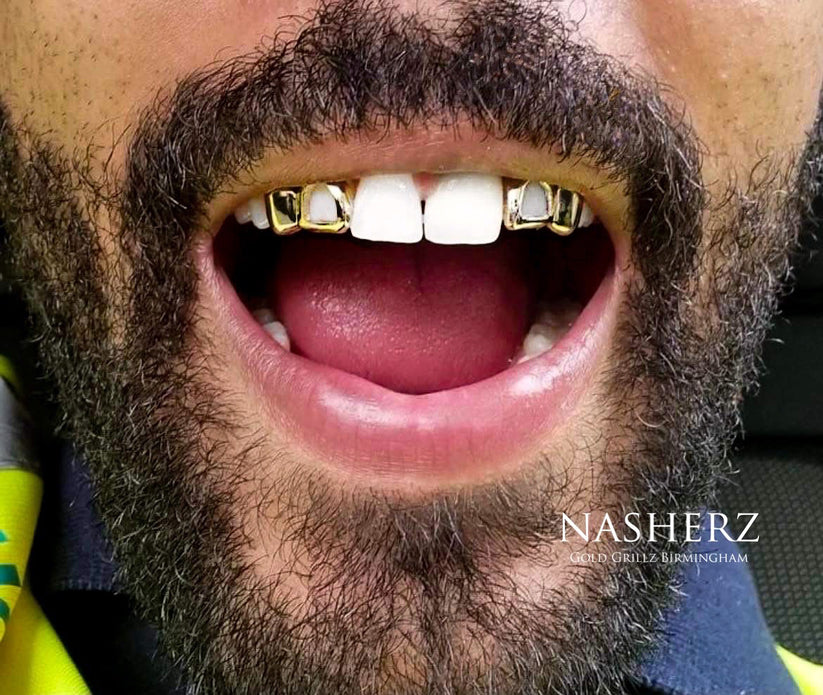 X2 Mirrors & X2 Windows (Any Position) – Nasherz Gold Grillz